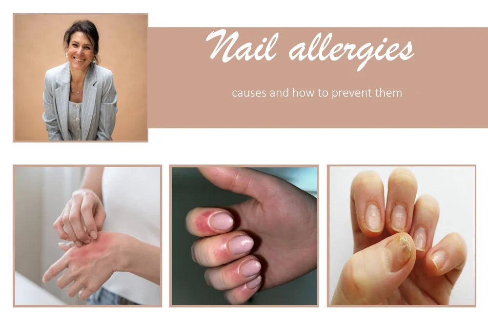 Nail allergy: causes and how to prevent it – Magnetic Nail Design UK